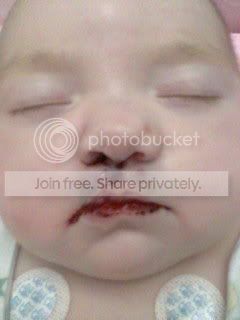 Molding Process Pictures | BabyCenter