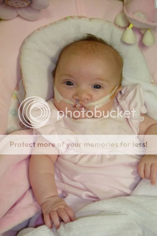 Molding Process Pictures | BabyCenter