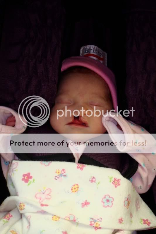 Molding Process Pictures - BabyCenter